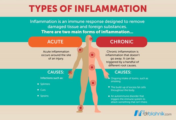 List of Teas that May Help to Reduce and Fight Inflammation - Ortho ...