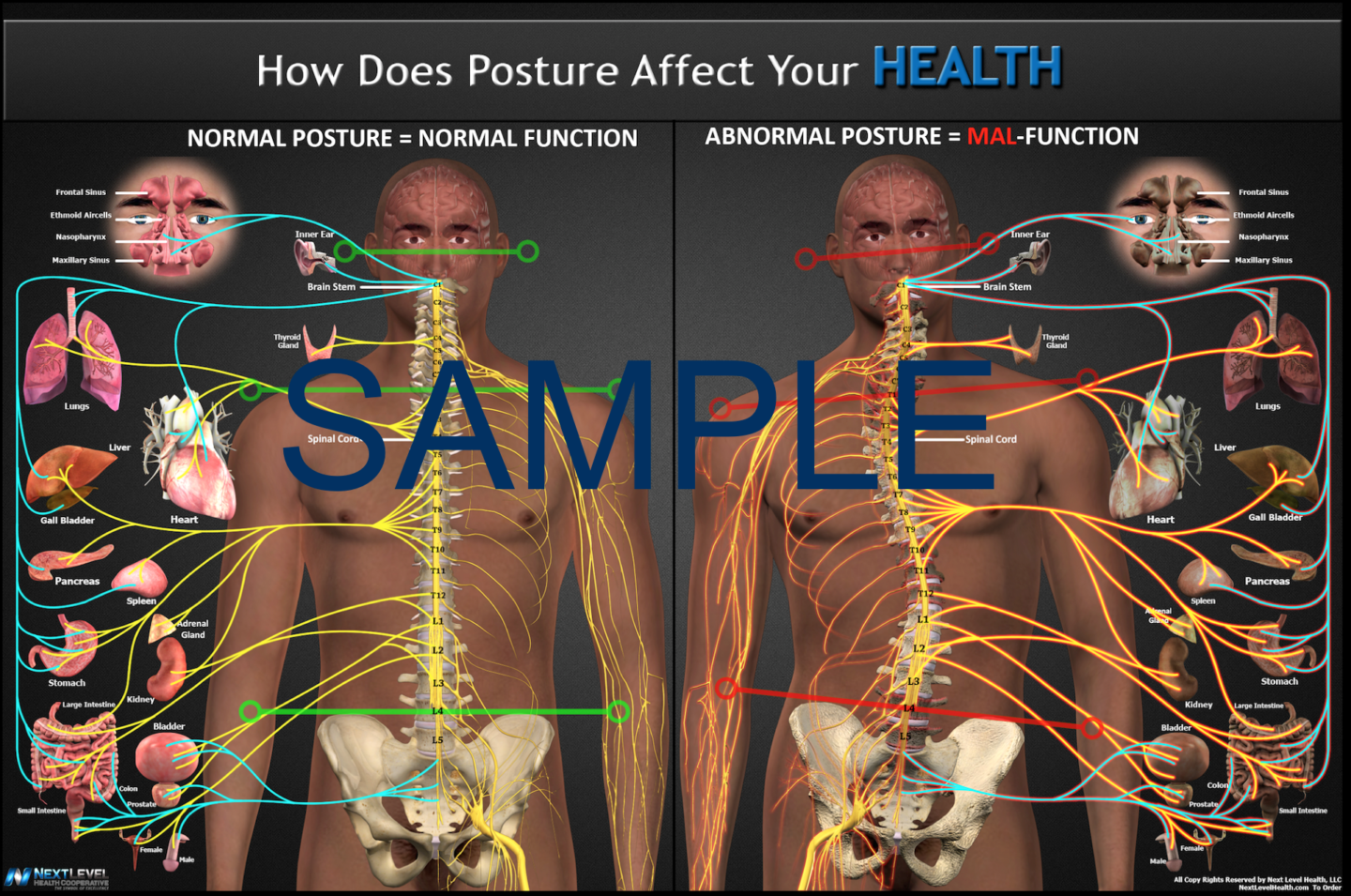 POSTURE POSTER 24X36 Digital Download - Ortho Integrative Medicine